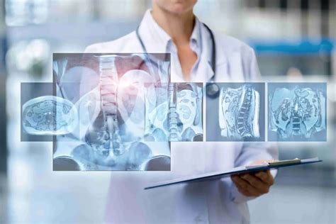 X Say Reduce Medical Errors With Artificial Intelligence In Radiology X Say