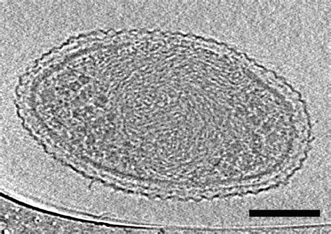 First Detailed Microscopy Evidence Of Bacteria At The Lower Size Limit