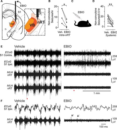 Local Or Systemic Ebio Treatment Reduces Non Convulsive Seizure