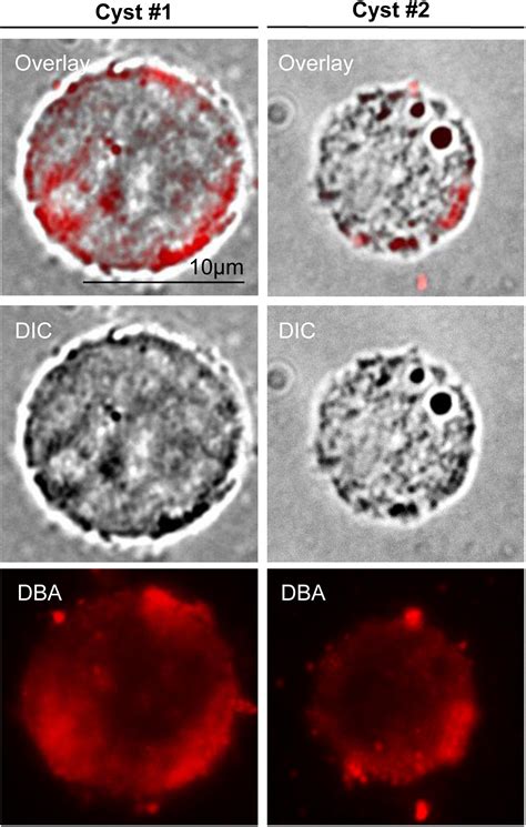 Presence Of Toxoplasma Gondii Tissue Cysts In Human Semen Toxoplasmosis As A Potential Sexually