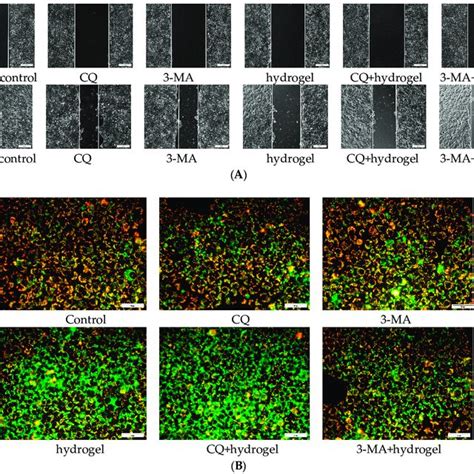 Cq And 3 Ma Attenuates The Inhibitory Effect Of Mtns Apsha Pnipaam