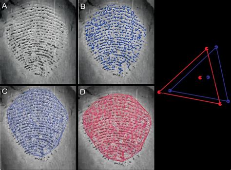 Determining Displacement Of The Skin By Fingerprint Image Analyses A Download Scientific