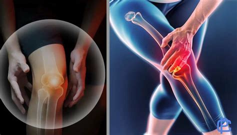 5 Essential Tips For Maintaining Optimal Joint Health