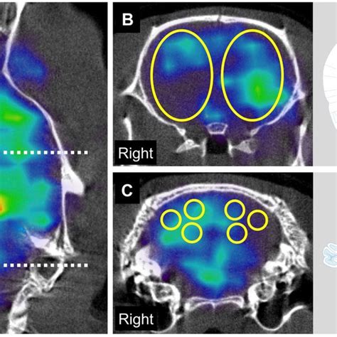 Single Photon Emission Computed Tomography Spect Computed Download Scientific Diagram