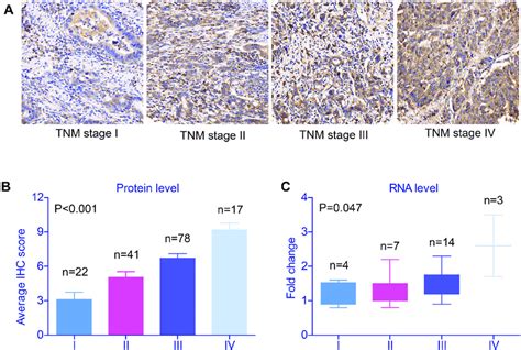 Validation Of Srpk1 Expression In Gastric Cancer Tissues A Srpk1 Download Scientific Diagram