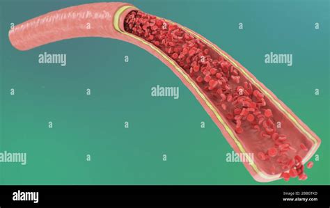 Cross Section Artery View Red Blood Cells Inside An Artery Vein Healthy Blood Flow