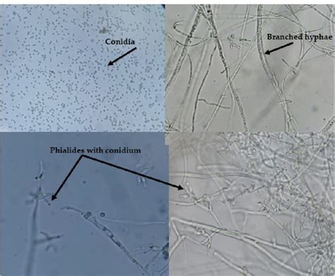 Colony Of The Native Strain Of Trichoderma Sp In Pda Medium Where A