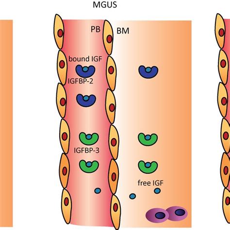 Schematic Overview Of Igf And Igfbp Levels In Controls Mgus And Mm