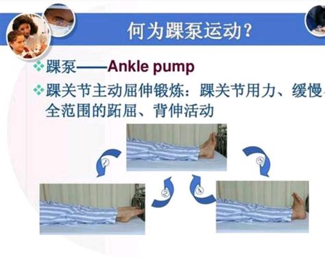 康复 长期卧床也要锻炼哦踝泵运动图示 春雨医生