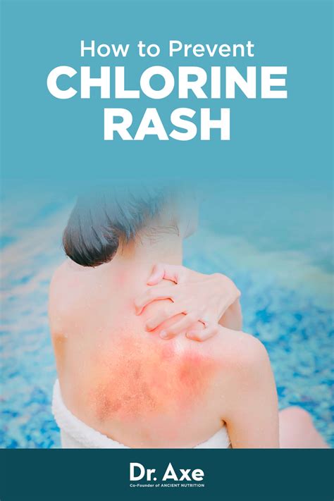 Chlorine Rash Treatment Pictures Symptoms Causes Hot Sex Picture