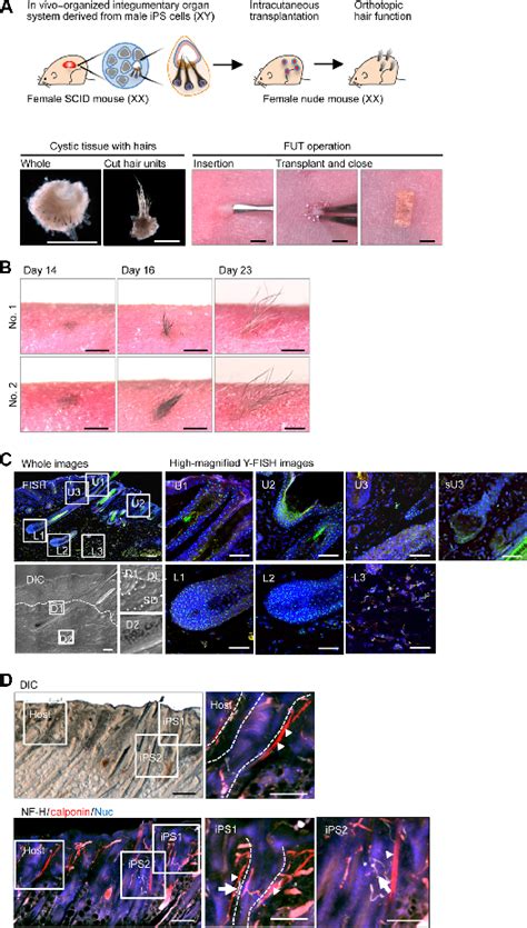 Transplantation Of The Bioengineered 3d Ios A Schematic