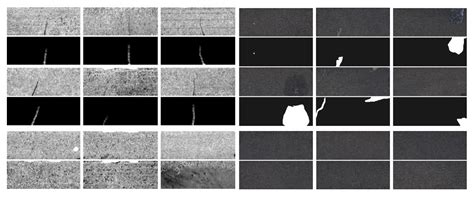 Anomalyseg Deep Learning Based Fast Anomaly Segmentation Approach For Surface Defect Detection