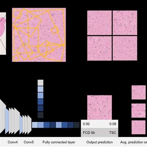 Workflow Overview A Workflow Beginning With Digitized Wsi Then
