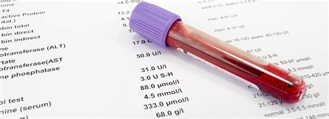 Linea Guida Su Come Leggere Gli Esami Del Sangue Gemi Health And Care