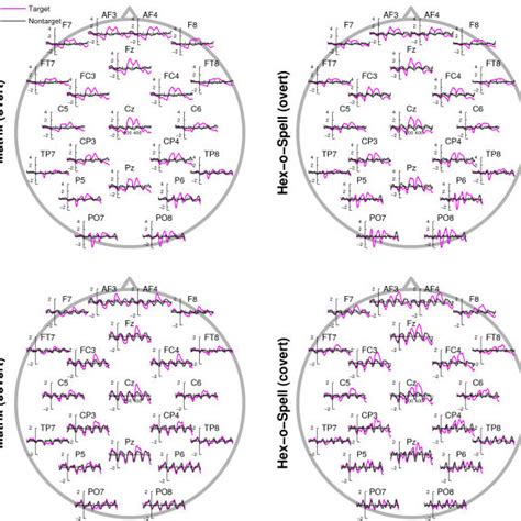 Distribution Of Electrode Sites On The Scalp Linked Mastoids Were Used
