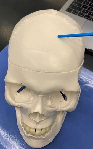 Anatomy Lab Practical Axial Skeleton Flashcards Quizlet