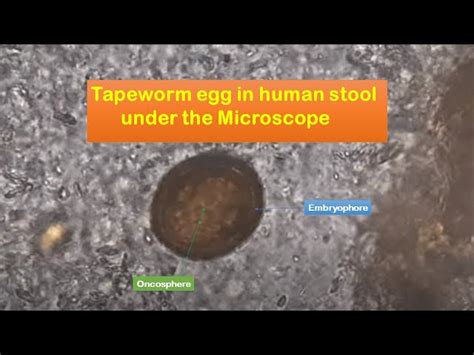 Tapeworm Segments In Human Stool