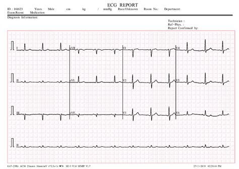 ecg lead classification object detection dataset and pre trained model
