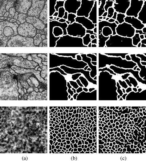 Figure 1 From One Shot And Partially Supervised Cell Image Segmentation Using Small Visual