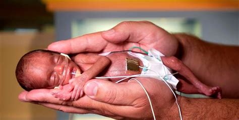 Дутуу төрөлт Жирэмсний тээлтийн Tserensambuu Sharav Facebook