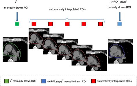 Figure 3 From A Semi Automatic Approach For Epicardial Adipose Tissue