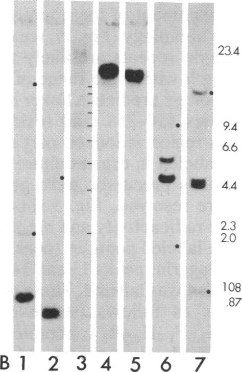 A Northern Blot Of Human Epidermal Polya Enriched Rna Probed With