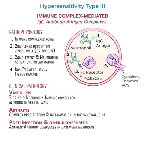 Clinical Pathology Glossary Hypersensitivity Type Iii Ditki Medical And Biological Sciences