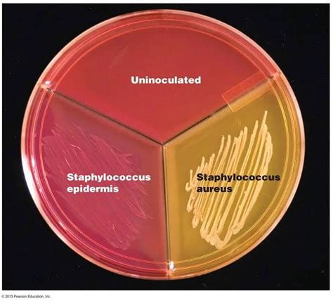 Mannitol Salt Agar Principle Uses And Results Microbe Online