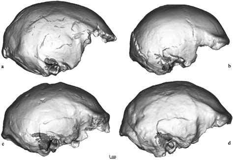 Right Lateral Views Of The 3d Reconstructions Of The Skull And Of The