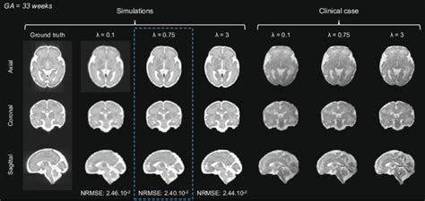 Appreciation Of The Quality Of Sr Reconstruction Depending On The Download Scientific Diagram