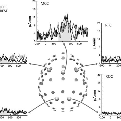 Dipole Positions And Source Waveforms Of Left And Rest Subjects