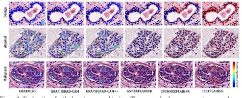 Towards The Explanation Of Graph Neural Networks In Digital Pathology With Information Flows