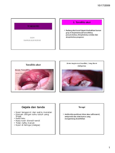 Tonsilitis Pdf