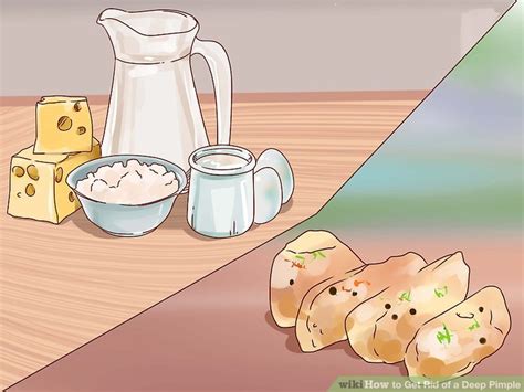 Ways To Get Rid Of A Deep Pimple WikiHow