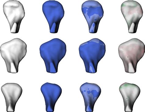 Overview Of Condyle Segmentations First Column Manual Segmentation