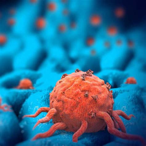 تومورهای خوش‌خیم داروسازی اکتوورکو