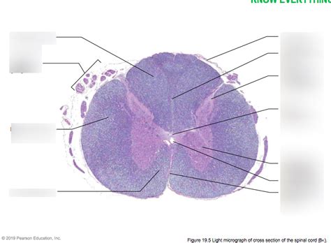 Light Micrograph Off Cross Section Of Spinal Cord Diagram Quizlet