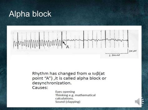 Eeg Basic To Practice 2 Ppt