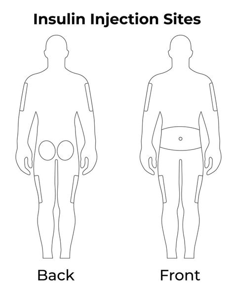 Insulin Injection Sites Science Design Illustration Diagram 50010760 Vector Art At Vecteezy