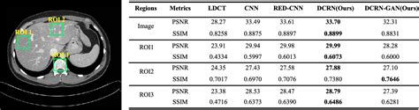 Figure 10 From Deep Cascade Residual Networks Dcrns Optimizing An