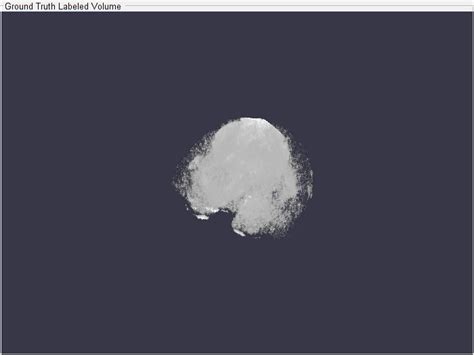 3 D Brain Tumor Segmentation Using Deep Learning Matlab And Simulink