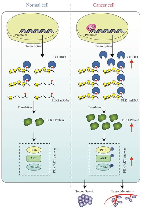 Elk1 Mediated Ythdf1 Drives Prostate Cancer Progression By Facilitating The Translation Of Polo