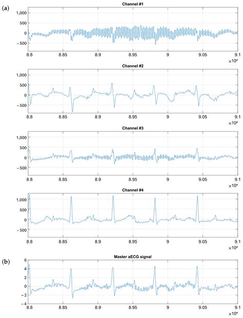 Electronics Free Full Text Pca Based Preprocessing For Clustering Based Fetal Heart Rate