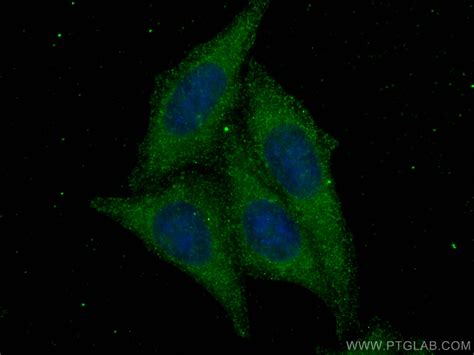 Mtor Antibody 81670 1 Rr Proteintech