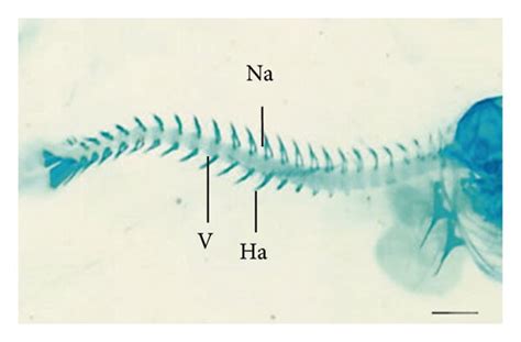 Vertebral Column Development Timing And Progression Of Larval And