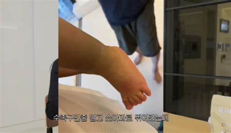 손연재 19개월 아들 염증고름에 깜짝…너무 심해 수족구인 줄 텐아시아