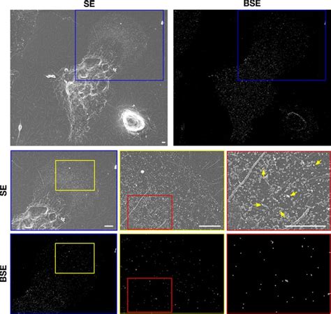 Figures And Data In Release Of Cholesterol Rich Particles From The Macrophage Plasma Membrane