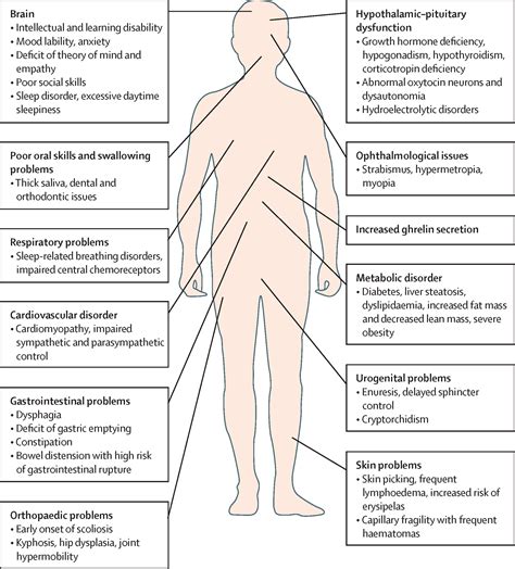Hypothalamic Dysfunction