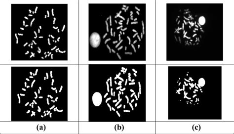 Segmentation Results For Watershed Transformation Download Scientific Diagram