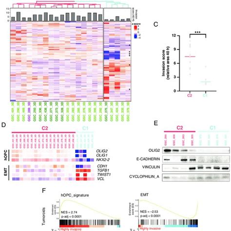 Transcriptomic Analysis Reveals 2 Types Of Diffuse Midline Glioma A Download Scientific